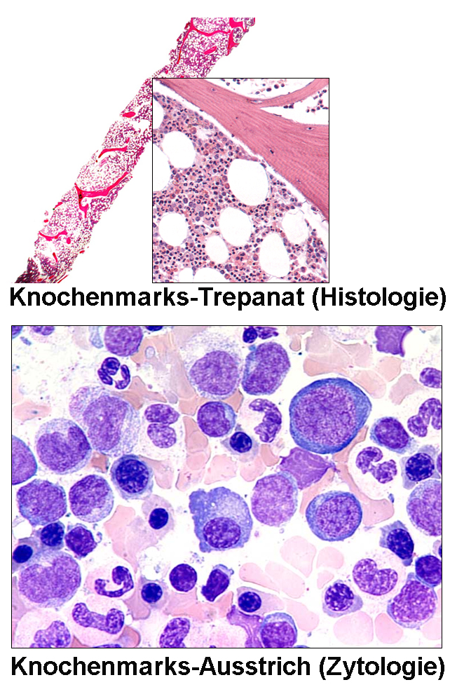 Pathologie | Hämatopathologie | UMG