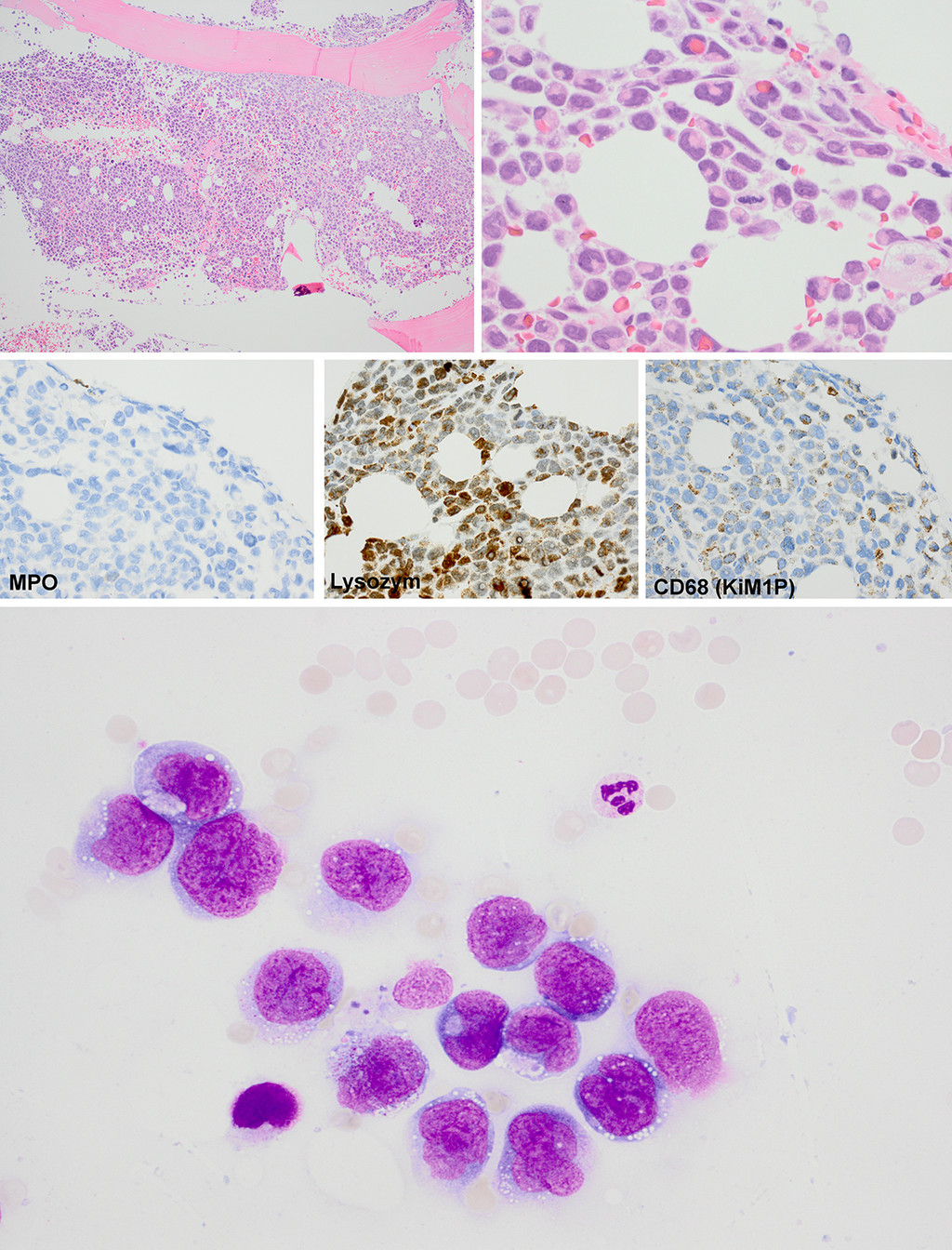 Pathologie | Hämatopathologie | UMG