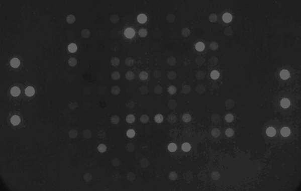 Pathologie | Proteomic Pathology | UMG