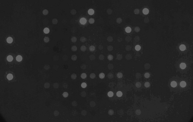 Pathologie | Proteomic Pathology | UMG